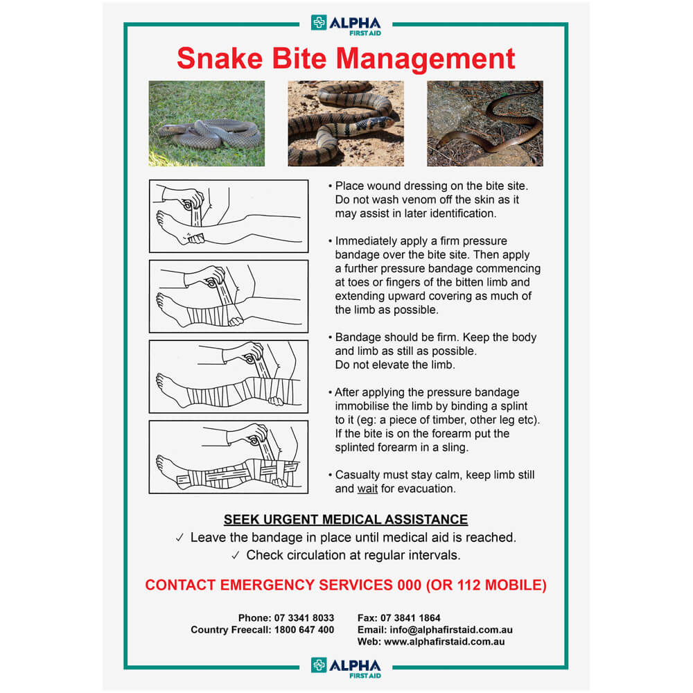 First Aid For Snake Bite Snake Bites, Prevention & Treatment